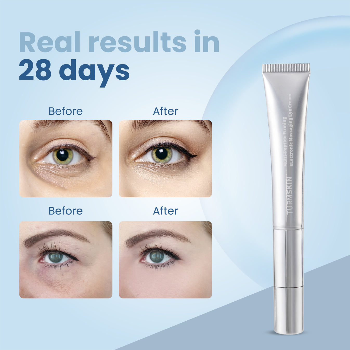 Wrinkle Eraser Electronic Massaging Eye Cream by TurmSkin